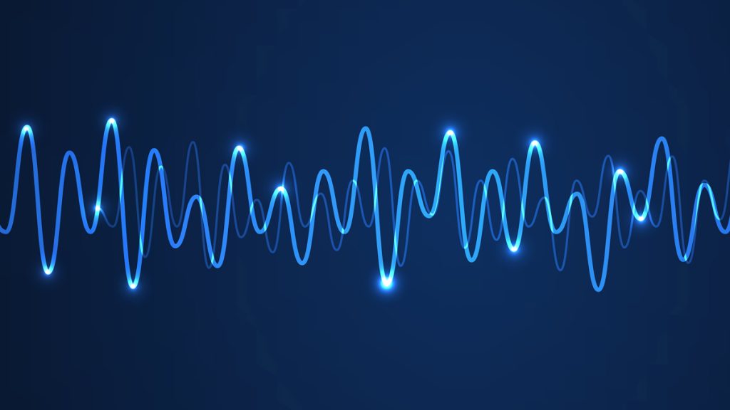 What is Decibel (dB), Meaning, Benefits, Objectives, Applications and ...